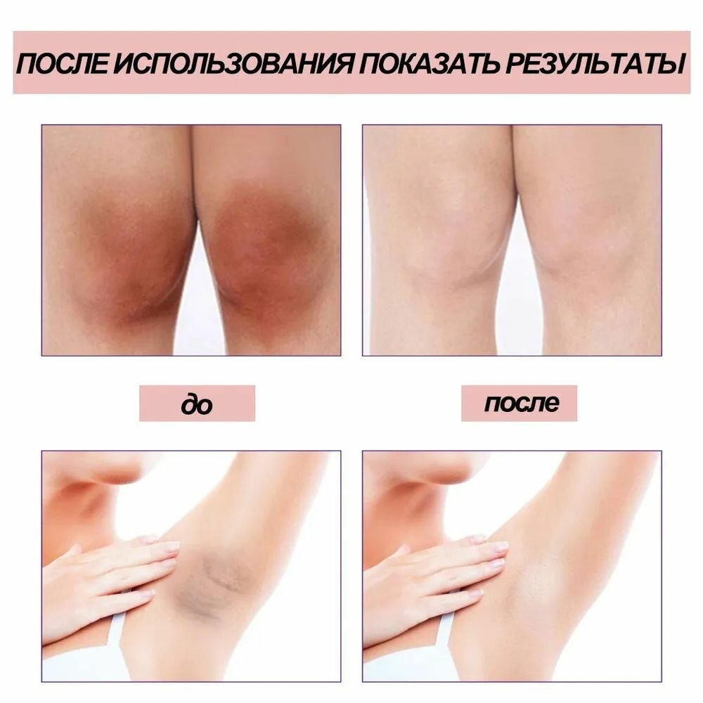 Крем для ухода за кожей