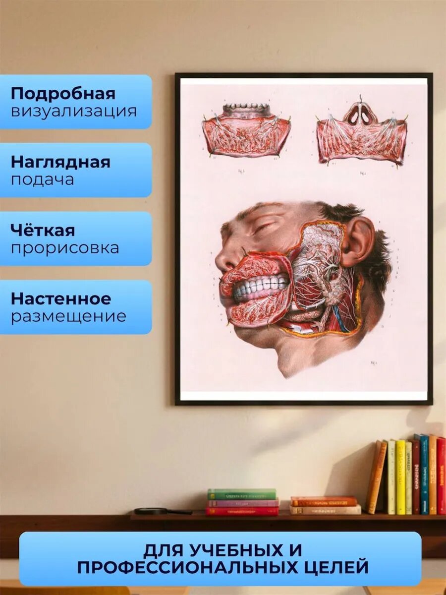 Постер медицинский, нижнечелюстная железа, стоматология, А3 анатомия, хирургия