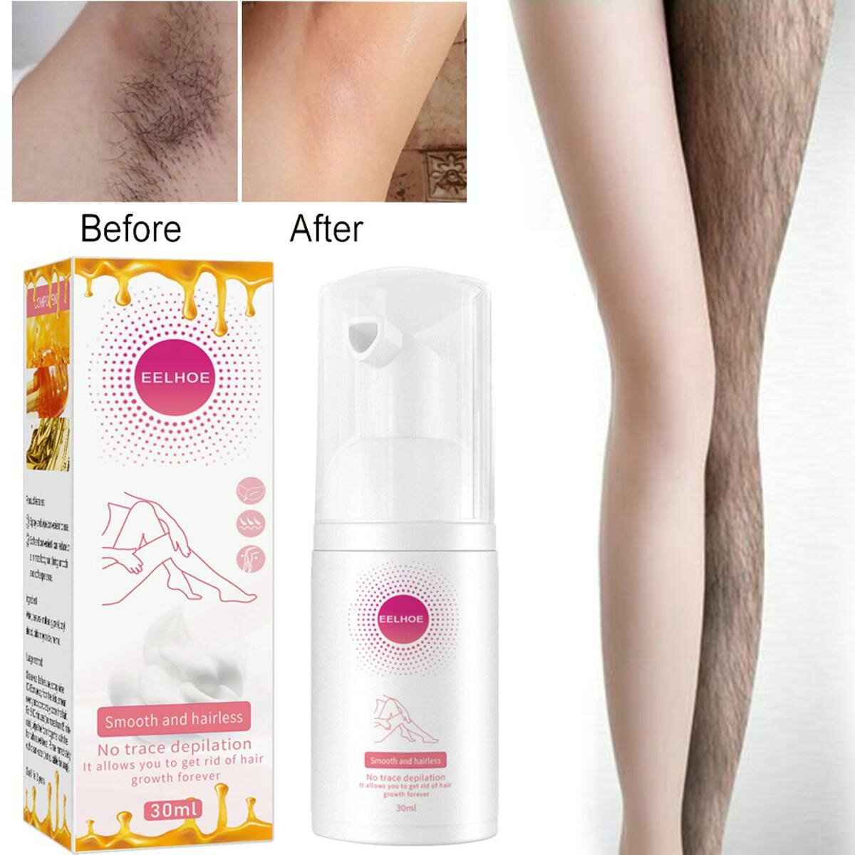 Безболезненное удаление волос Спрей Ингибитор роста волос Подмышки Ноги Руки Удаление волос Крем для депиляции Питание Восстановление Уход за кожей тела