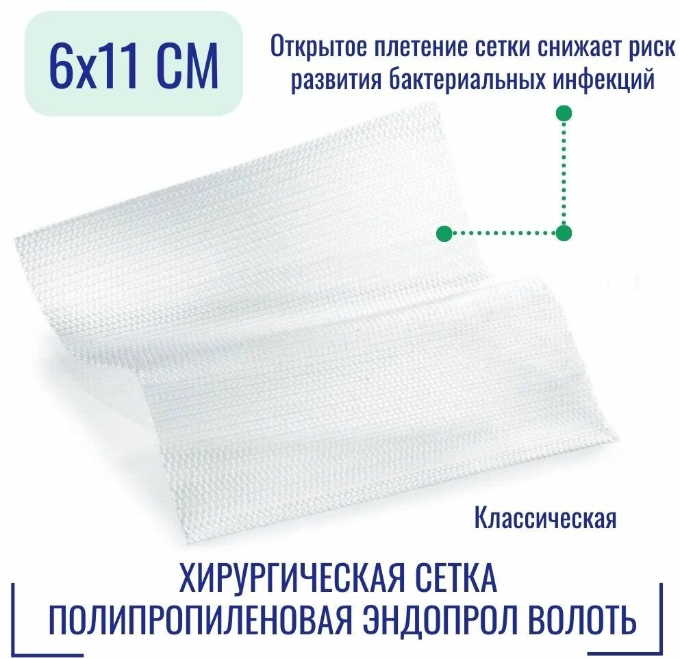 Хирургическая сетка полипропиленовая эндопрол Волоть (6 х 11 см.) классическая