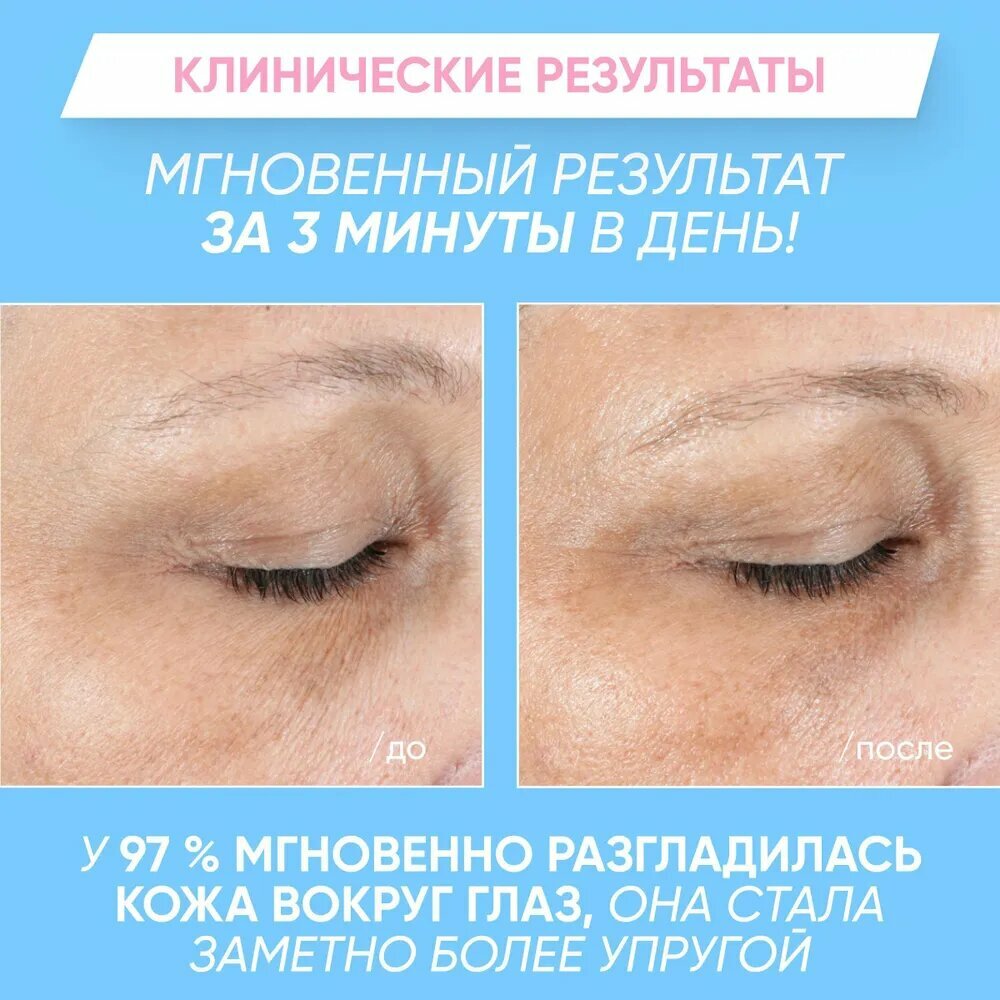 NuFACE Микротоки Fix — фото 1