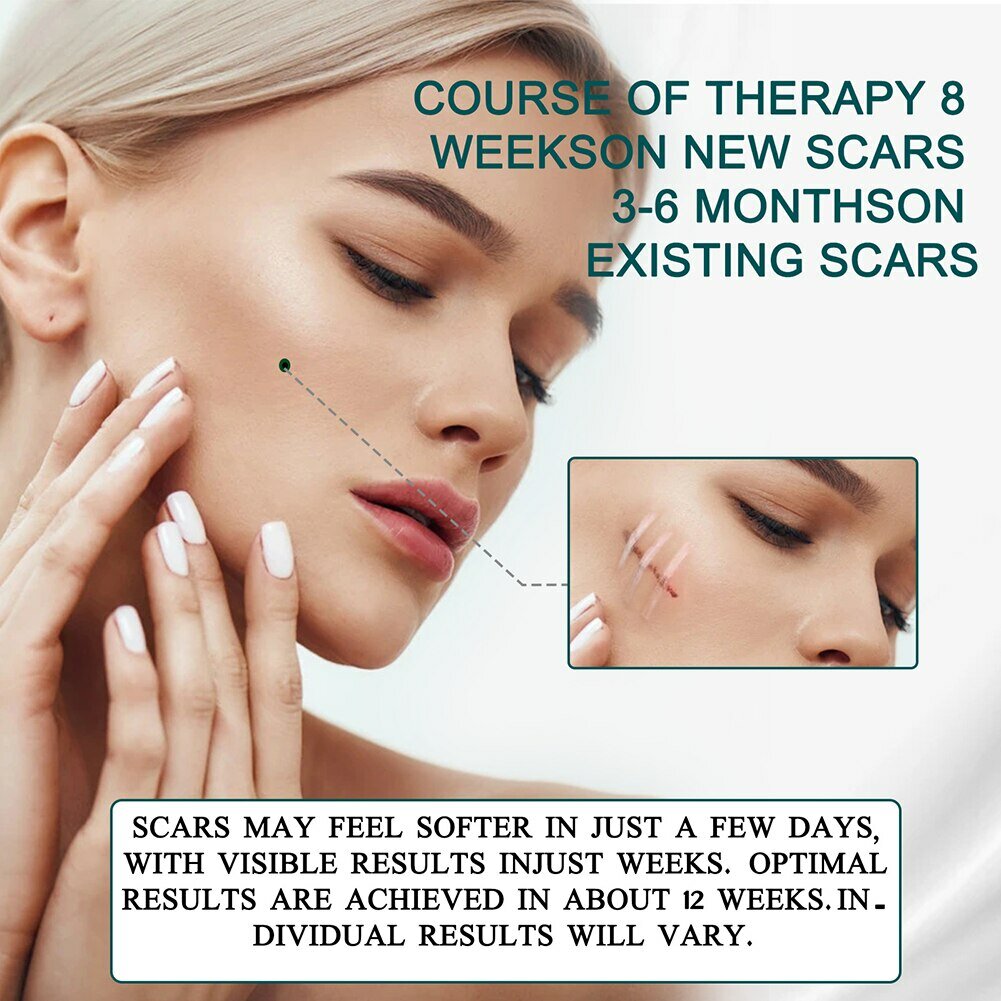 4x300 см Высокоэффективная косметическая силиконовая самоклеящаяся лента для удаления рубцов, пластыри для лечения шрамов от угревой сыпи и ожогов