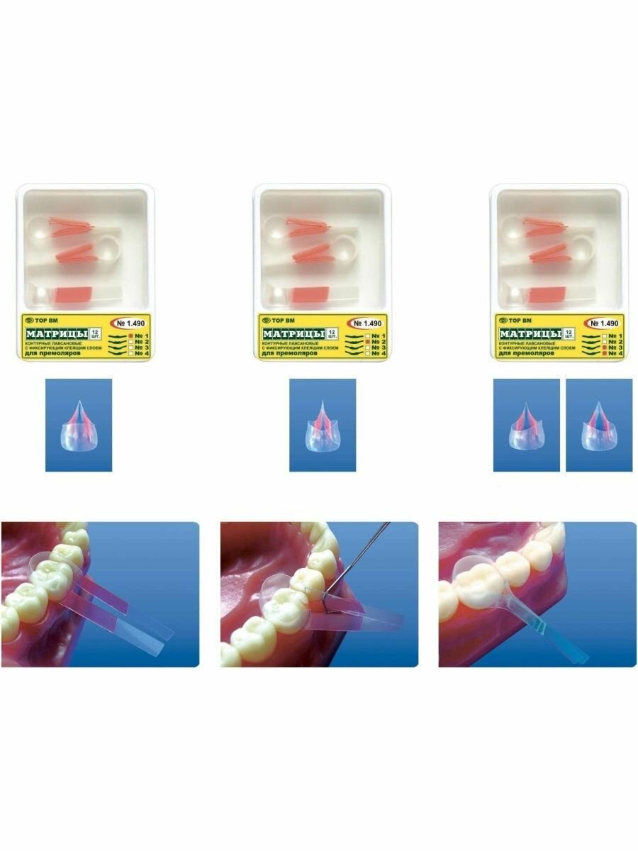 1.490 Матрицы контурные лавсановые с фиксирующим клеящим слоем для премоляров набор 4-х типов ТОР ВМ, 36 шт.