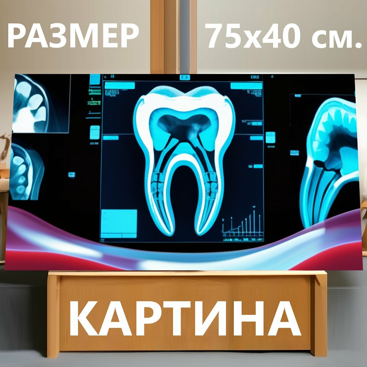 Картина на холсте "Клинические исследования рентгена в стоматологии" на подрамнике 75х40 см. для интерьера