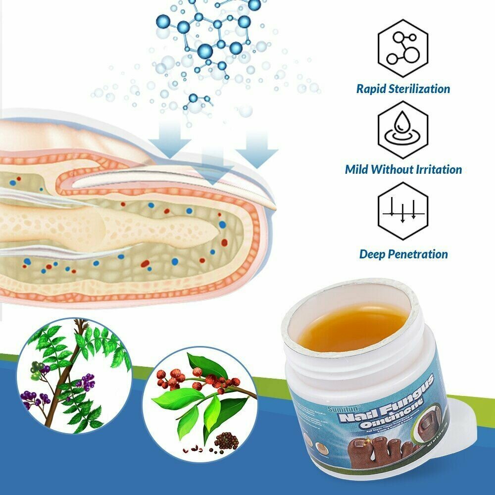 Средство от грибка ногтей Sumifun Nail Fungus Ointment, 20 г