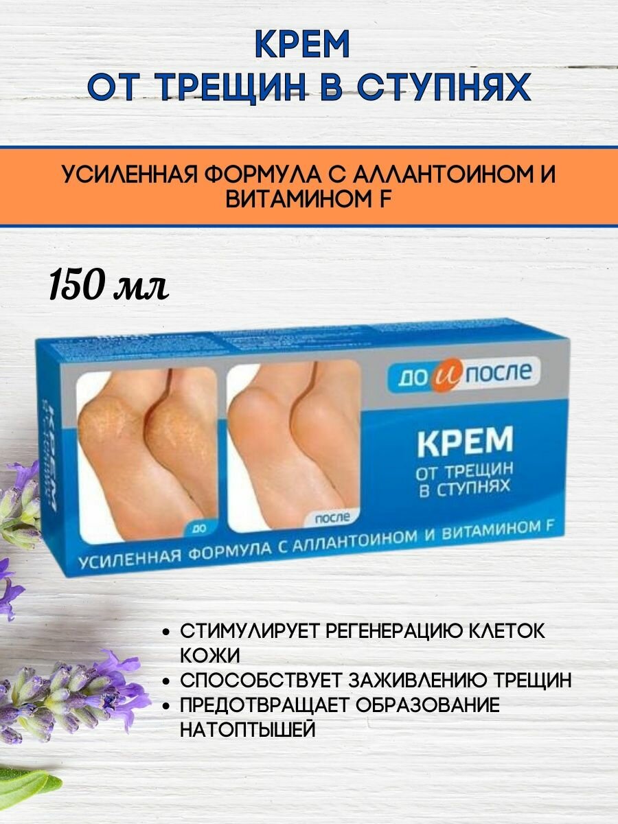До и после Крем для ног от трещин в ступнях 1шт 150мл