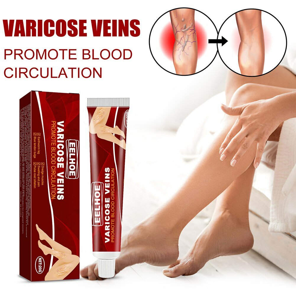 20 г крем для лечения варикозного расширения вен, васкулита, флебита, паучьих паучков, мазь для снятия боли, пластырь дл