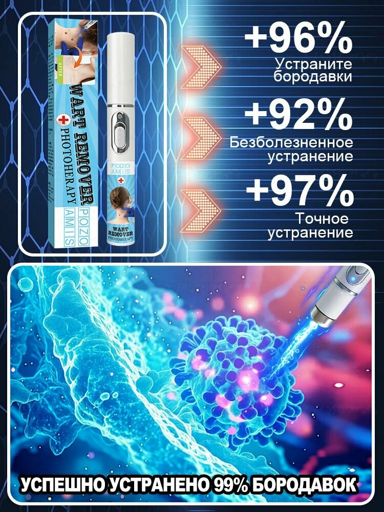Лазерная ручка для удаления бородавок всех типов: папилломы, плоские, подошвенные, венерические, нитевидные и инкрустированные. Безопасно для любой зоны тела.1 упаковка. удаление папиллом удаление подошвенных бородавок удаление нитевидных б