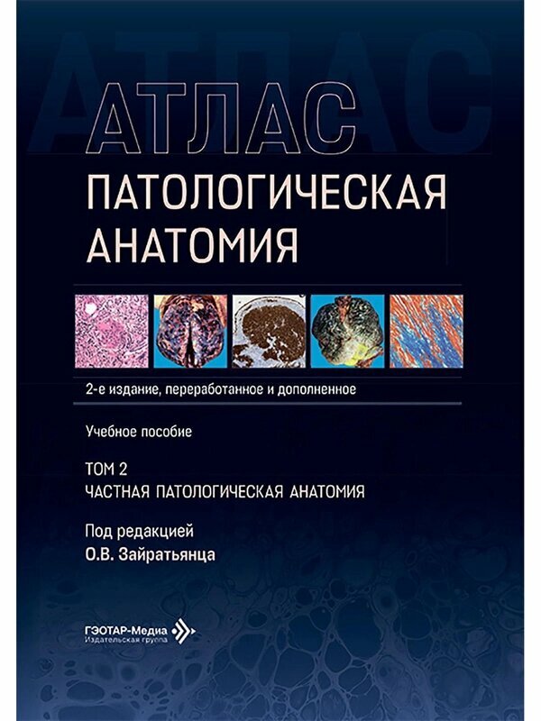 Патологическая анатомия. Атлас. В 2 т. Т. 2: Частная патологическая анатомия: Учебное п. (Под ред. Зайратьянца О. В.)