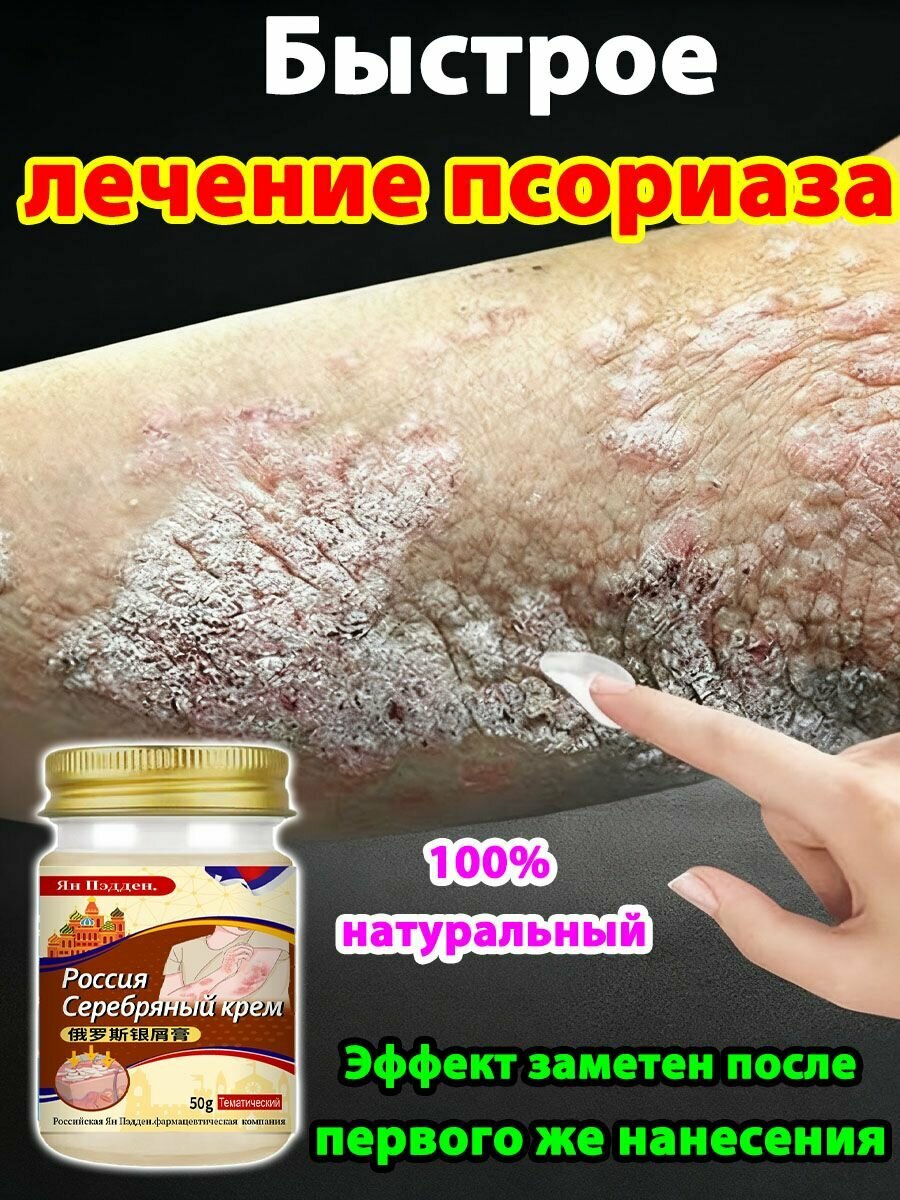 Крем мазь от псориаза от прыщей и дерматита экземы 50 мл