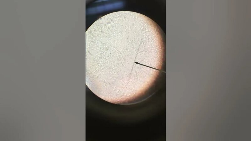Hanging drop method: Proteus Vulgaris under a microscope - Смотреть ...