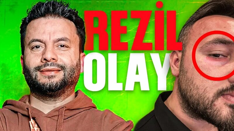 The true face of hakki alkan! - Смотреть онлайн в поиске Яндекса по Видео