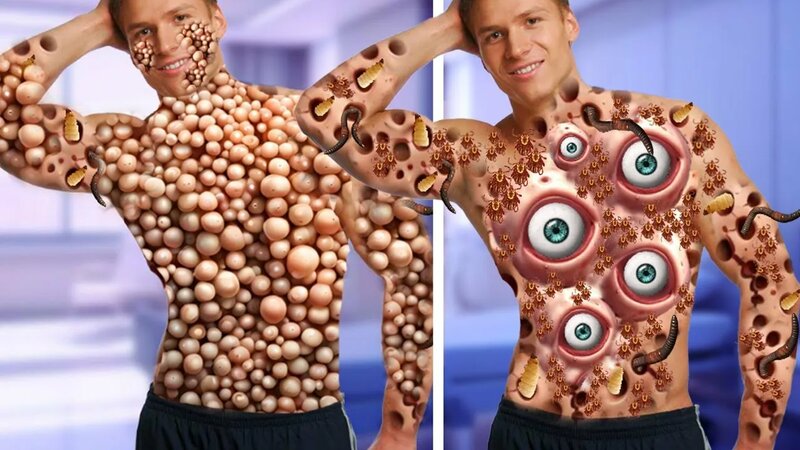 ASMR Animation Remove Maggot, Dog Ticks and Eye Infected Body ...