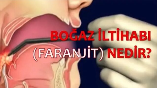 Boğaz İltihabi faranjit Nedir ? - Yandex Video aramada çevrimiçi izle