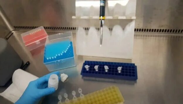 Virus DNA Extraction/ Virus RNA extraction/ Virus Nucleic Acid ...