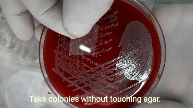 Staphylococcus and Enterococcus on blood agar and use of catalase test ...