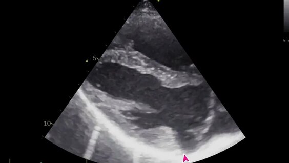 okul oncesi +annular ga 1 na 1 boyama: 783 video Yandex'te bulundu