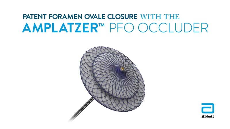 Patent Foramen Ovale Closure | Amplatzer PFO Occluder - Смотреть онлайн ...