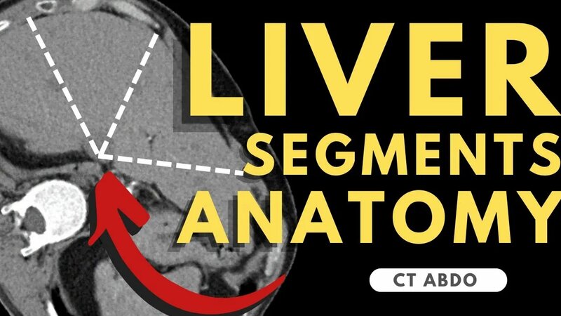 Liver Segments on CT scan | Radiology anatomy part 1 prep | Segmental ...