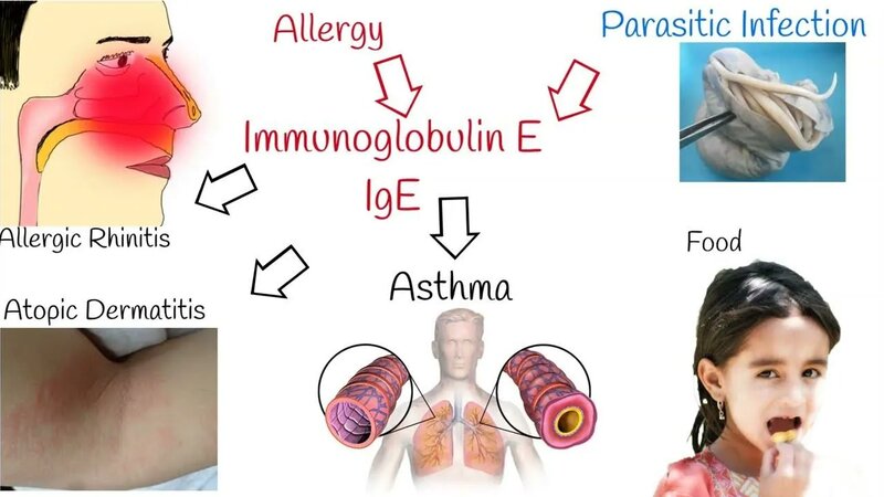 Blood Test: Immunoglobulin E (IgE) - what does a high immunoglobulin e ...