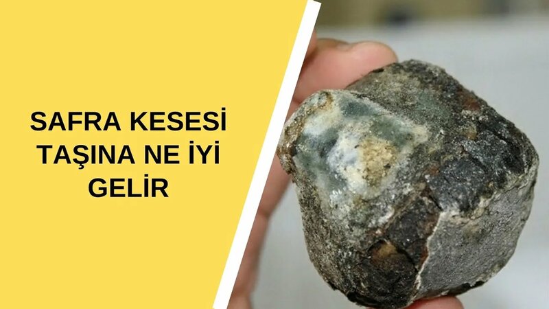 Safra Kesesinde Kaç Çeşit Taş Oluşur? Safra Kesesi Taşına Ne İyi Gelir ...