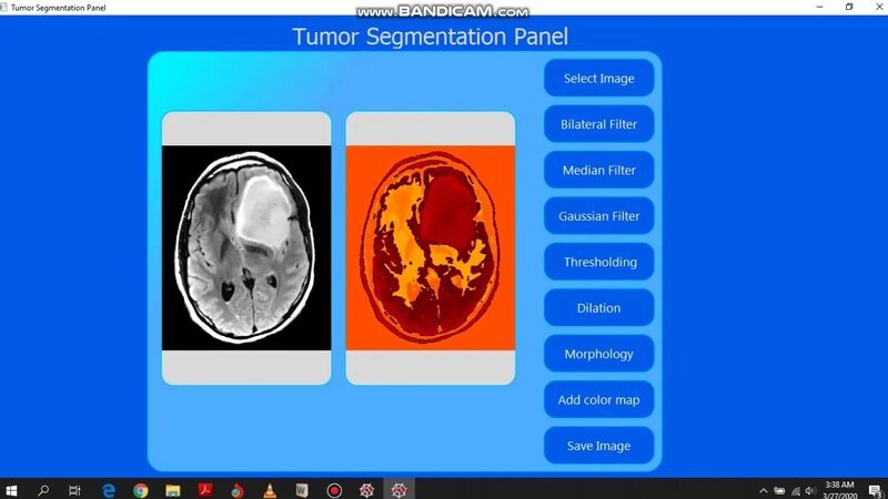 Brain tumor Segmentation using Python and openCV- PyQt GUI interface ...