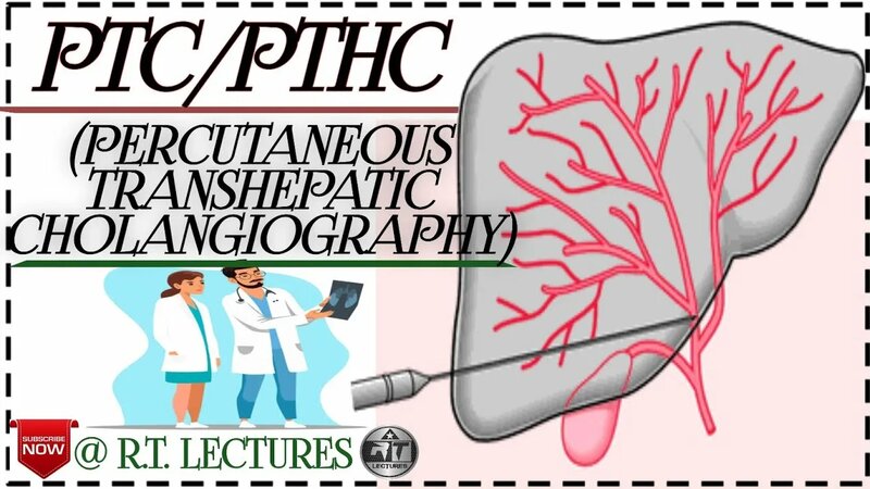 #PTC Procedure #Percutaneous Transhepatic Cholangiography Peocedure # ...