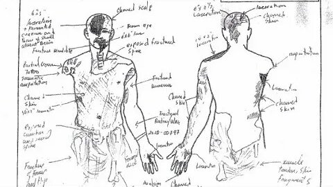 Kobe Bryant Autopsy Report - Смотреть онлайн в поиске Яндекса по Видео