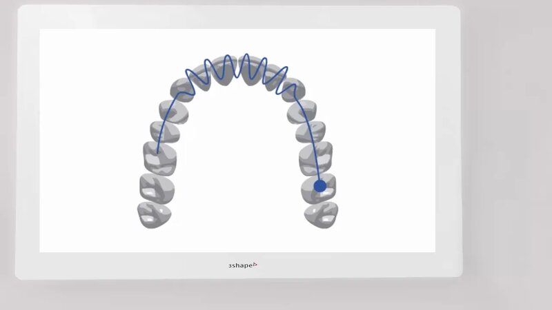 3Shape Trios Scan Strategy - Full Arch - Yandex Video aramada çevrimiçi ...