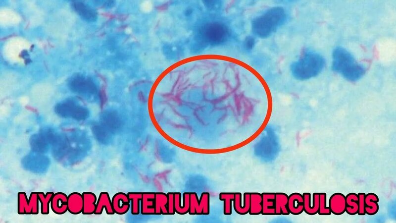 Identification Of Mycobacterium Tuberculosis || AFB Bacilli || TB ...