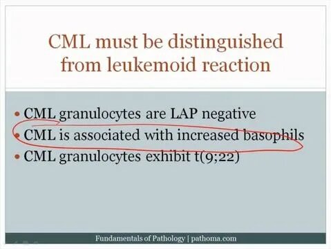 Pathoma Usmle - VI Глава - 4.Миелопролиферативные заболевания (МПЗ ...