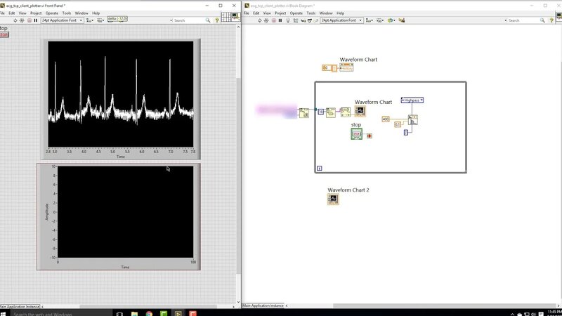 BME 214L Real-time filtering of streaming ECG data using LabVIEW - Смотреть онлайн в поиске ...