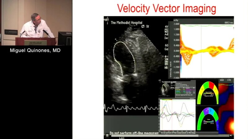 Regional Wall Motion & Stress Echo (Miguel Quinones, MD) December 6 ...