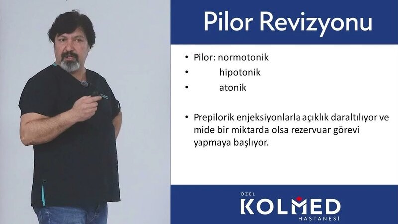Pilor Revizyonu - Op. Dr. Uğur Abakay - Yandex Video aramada çevrimiçi izle