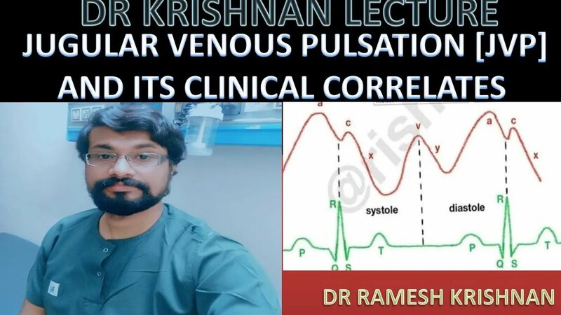 Jugular Venous Pulsation (JVP) and Its Clinical Correlates - Смотреть ...