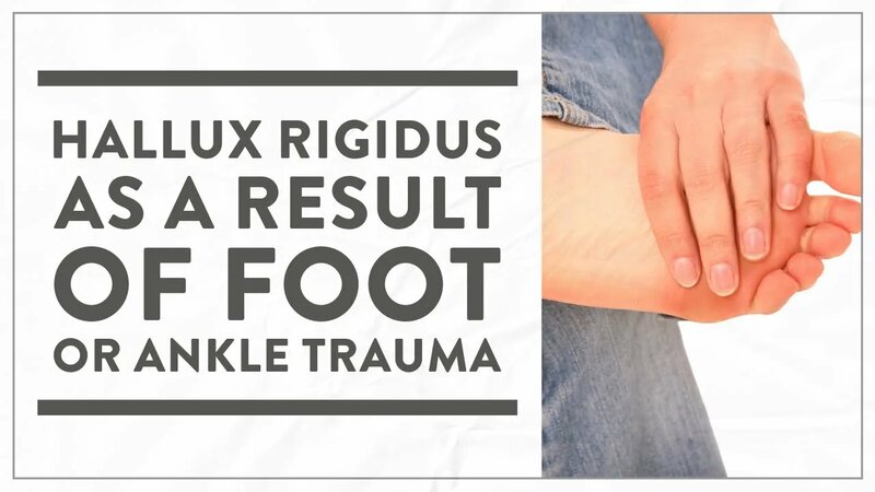 Hallux rigidus as a result of foot or ankle trauma - Yandex Video ...