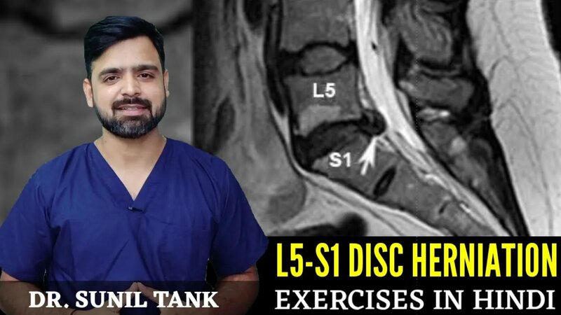 l4 l5 s1 herniated disc exercises | L4 L5 S1 disc bulge treatment ...
