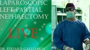 Лапароскопическая резекция почки / Laparoscopic left partial ...