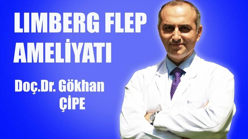 Kıl Dönmesi (Plonidal Sinüs) Tedavisi- Modifiye Limberg FLep Ameliyatı ...