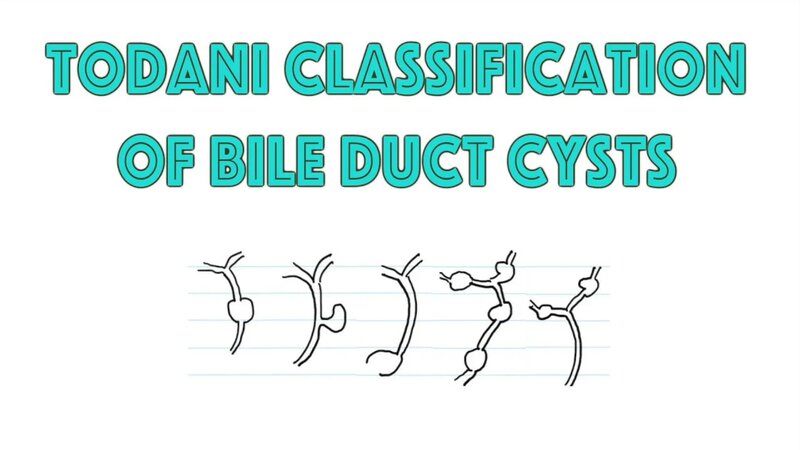 Bitesized radiology factoids: Todani classification | Radiology Nation ...