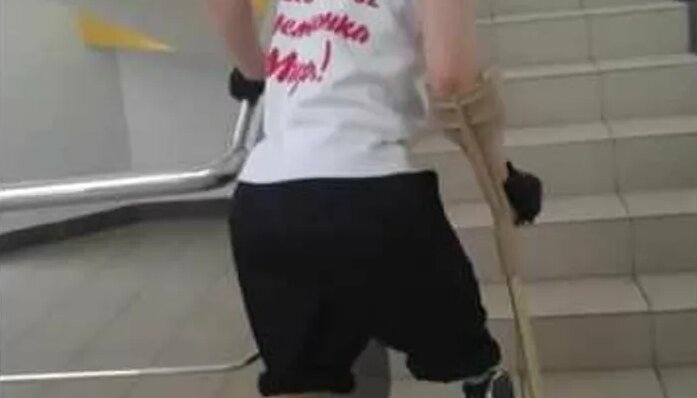 Видео Dak amputee | OK.RU - Смотреть онлайн в поиске Яндекса по Видео