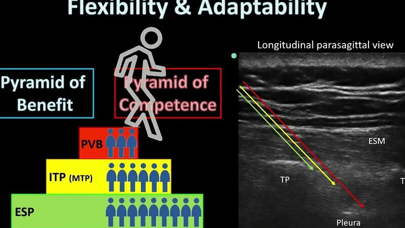 ESP Block - Where To Inject [2023] - Смотреть онлайн в поиске Яндекса ...