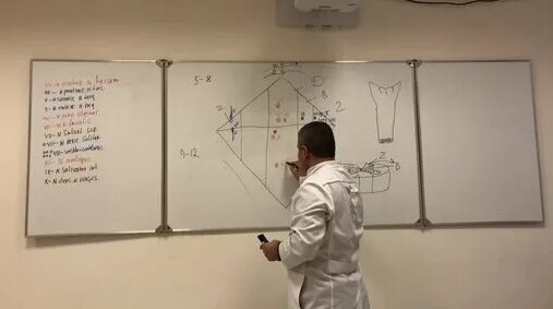 Ромбовидная ямка. Анатомия Ромбовидной ямки. Часть 2. Anatomy of the ...