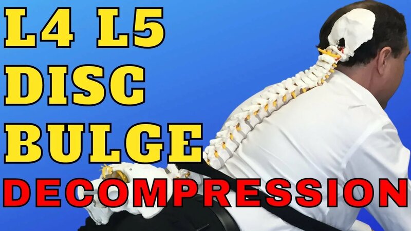 L4 L5 Disc Bulge Decompression Exercises | Best Exercise For L4 L5 Disc ...