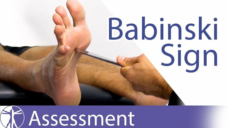 The Babinski Sign or Reflex | Upper Motor Neuron Lesion - Смотреть ...