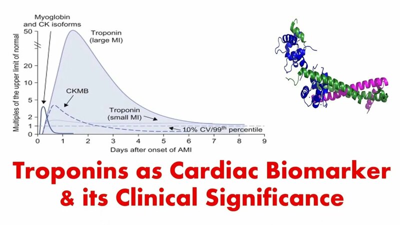 Troponins as Cardiac Biomarker its Importance &Clinical Significance ...