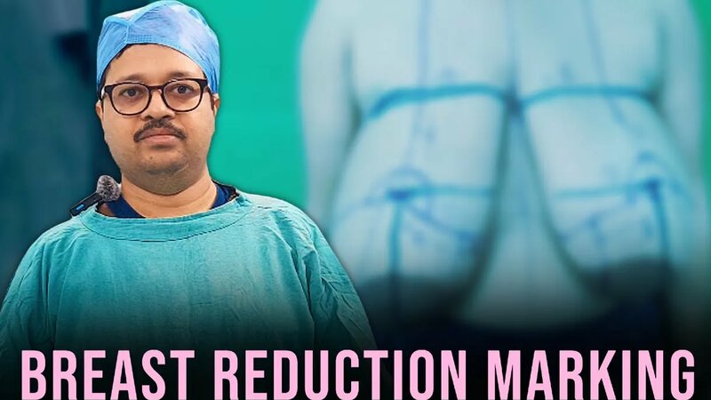 Breast Reduction Marking Explain by Dr. Jayanta Bain Plastic & Cosmetic ...