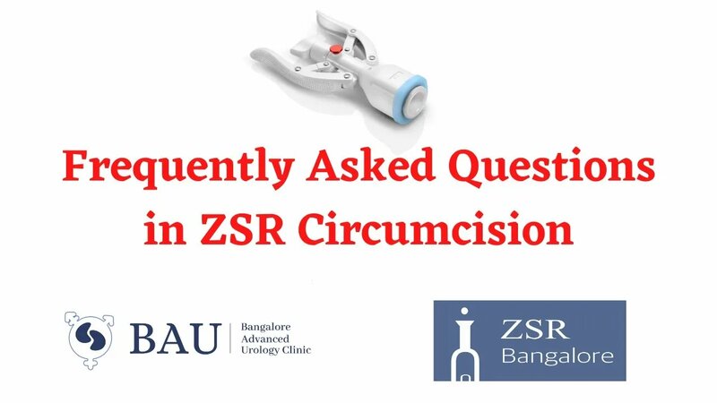 ZSR Circumcision - Most Frequently Asked Questions / A Complete patient ...