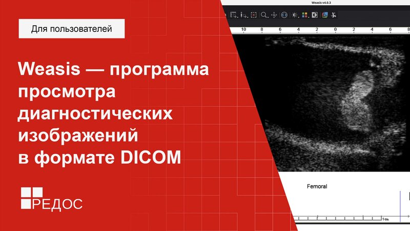 Weasis — программа просмотра диагностических изображений в формате ...