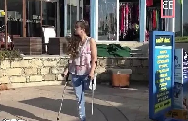 Cute Amputee One Leg Girl with Nice Jean and Crutching at beach zone ...